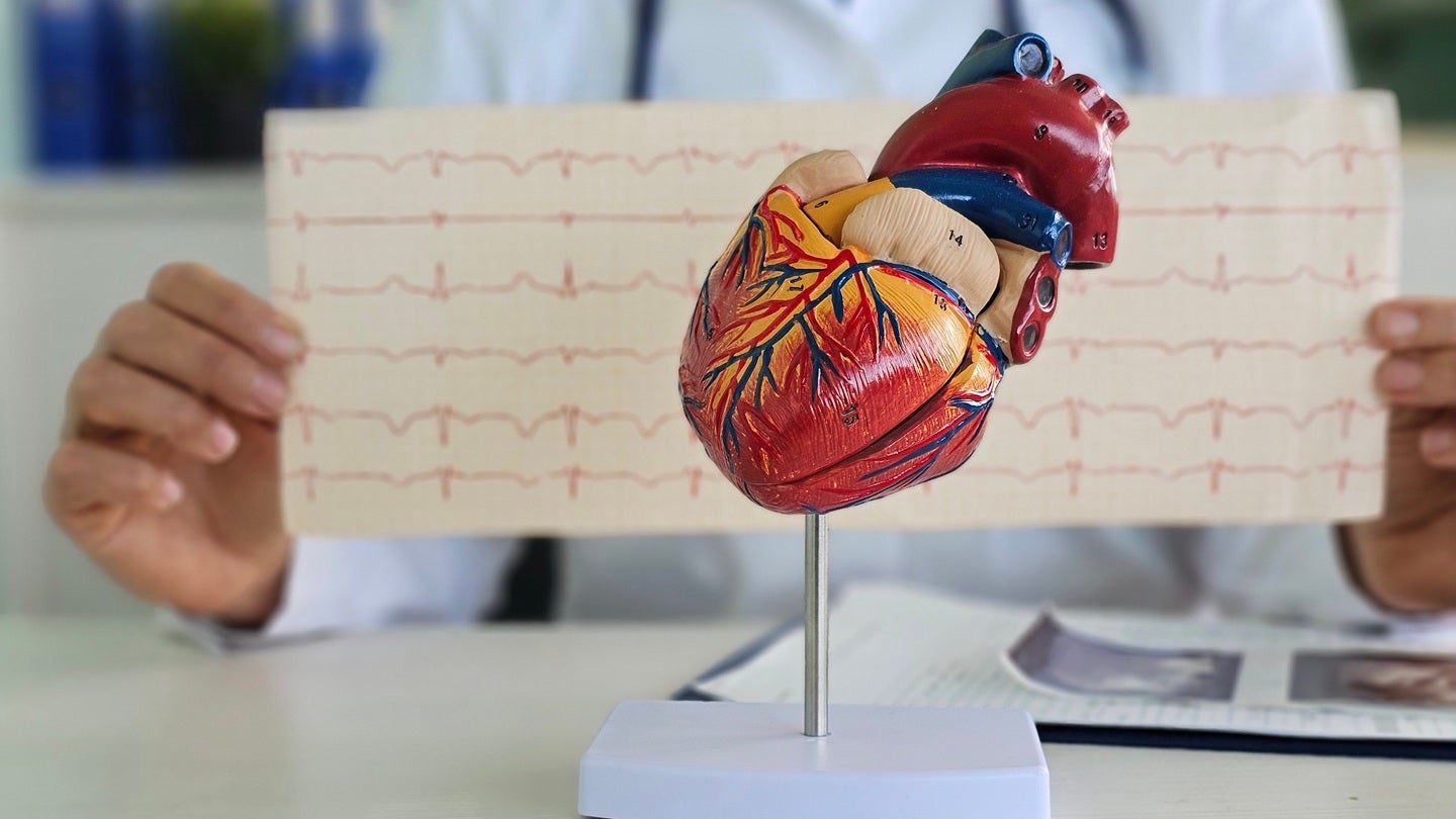 FDA grants 510(k) clearance for Tempus AI’s ejection fraction software