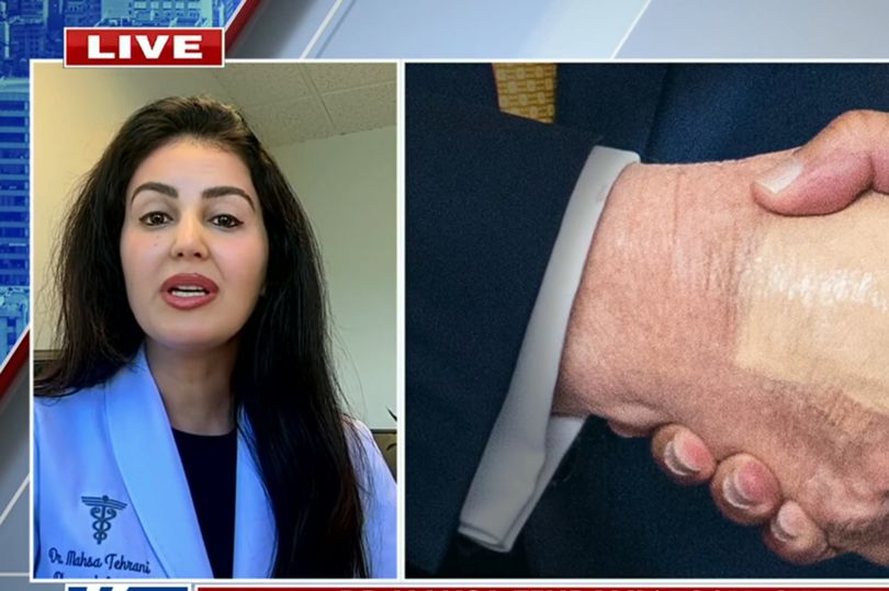 Fox News issues urgent McDonald's warning to Donald Trump over health condition