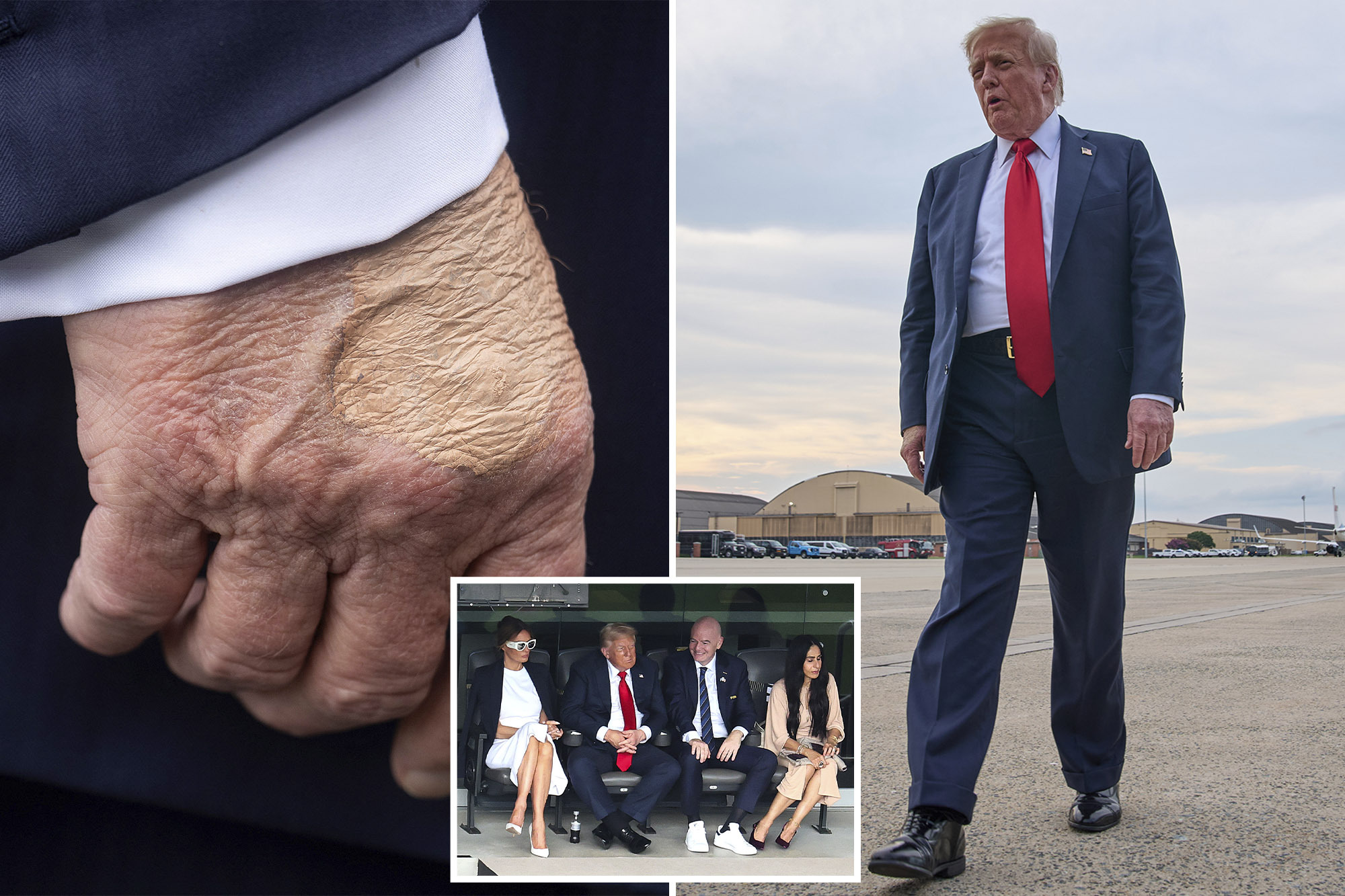 Trump suffering from chronic condition after lower leg swelling sparks ...