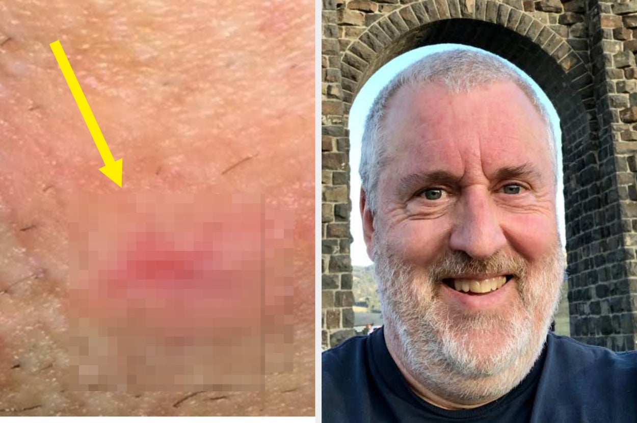 I Had An Itch In A Very Private Spot. Things Turned Tragic After I ...