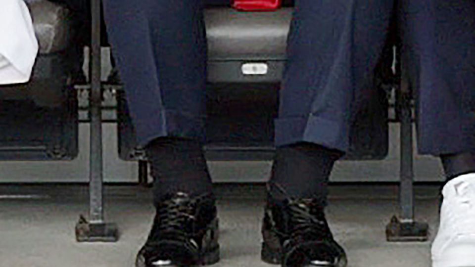 Trump diagnosed with chronic venous insufficiency following leg swelling