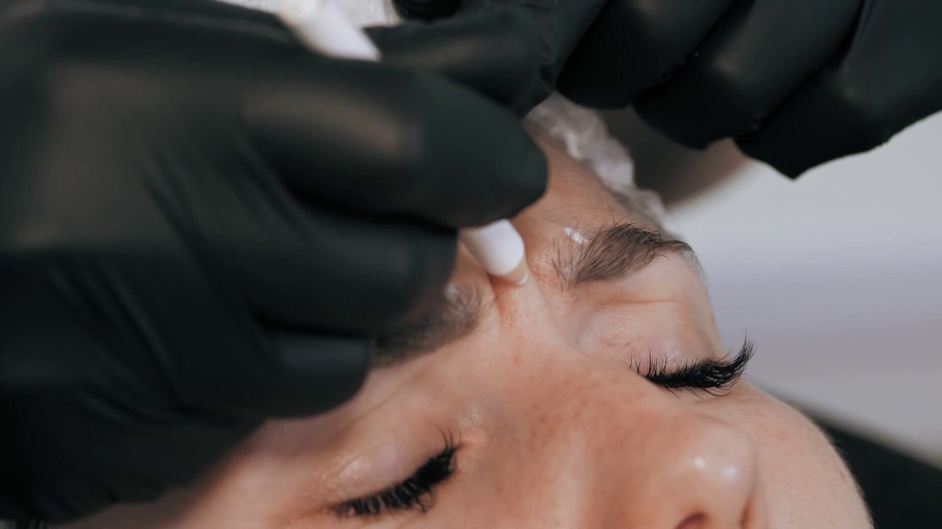 From counterfeit Botox to unlicensed injectors, here’s how to avoid ...