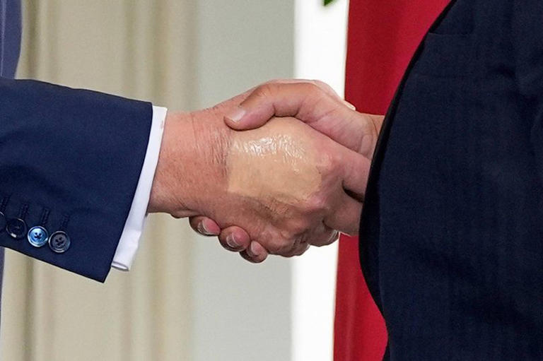 ABC airs shocking update on Donald Trump's swollen ankles after diagnosis