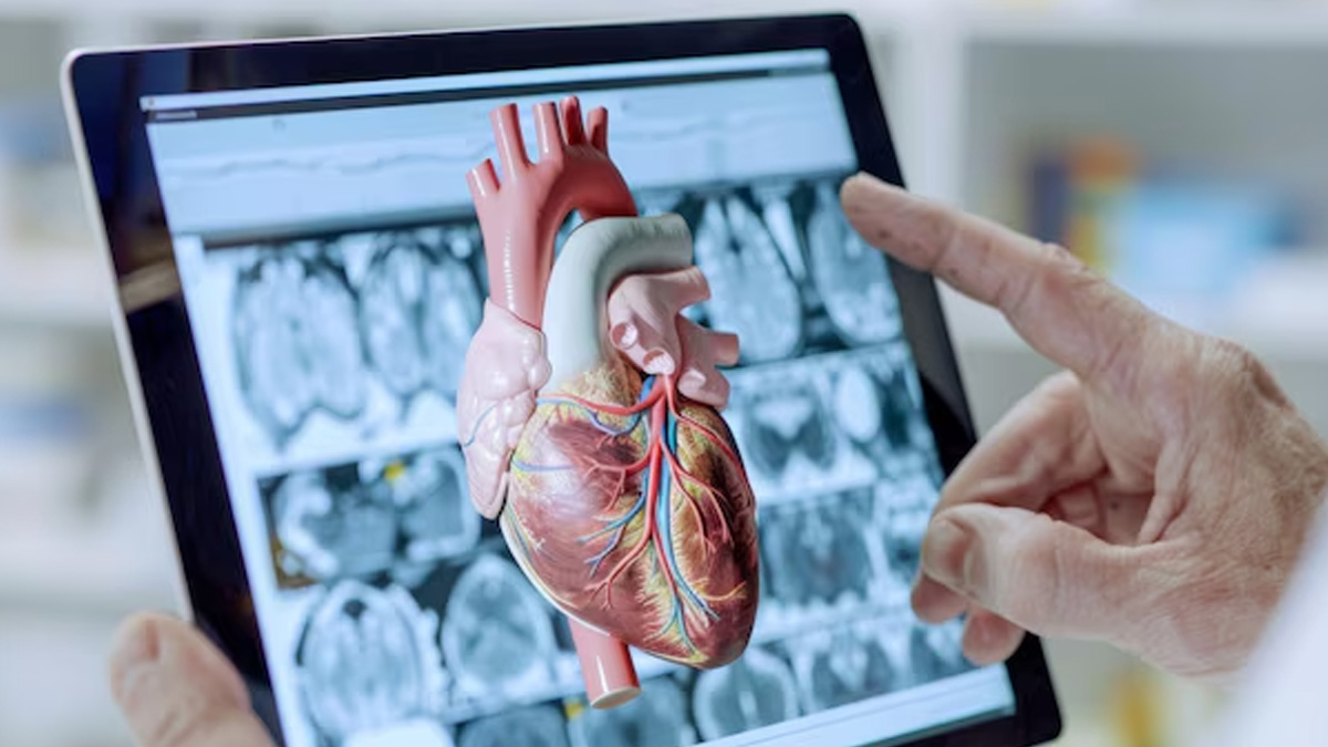 AI Technology Offers Hope for Early Structural Heart Diagnosis