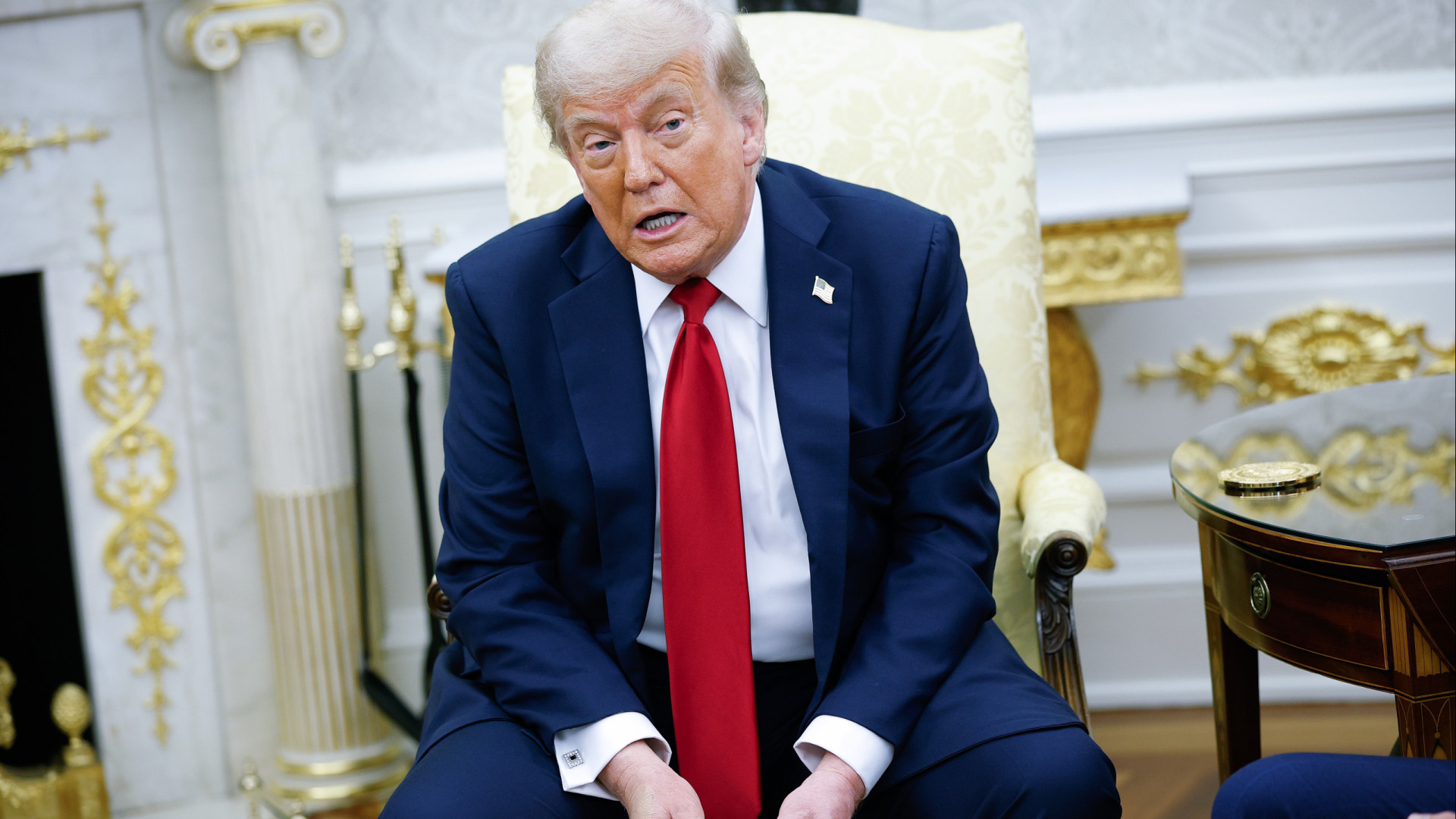 What's chronic venous insufficiency, the disease plaguing the US president?