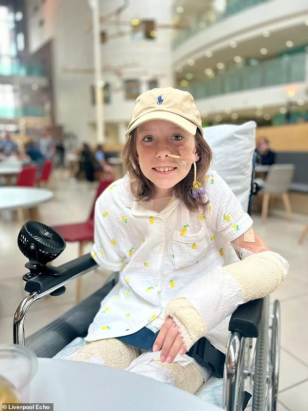 Schoolgirl has three limbs amputated after 'not unusual' bruise turned ...