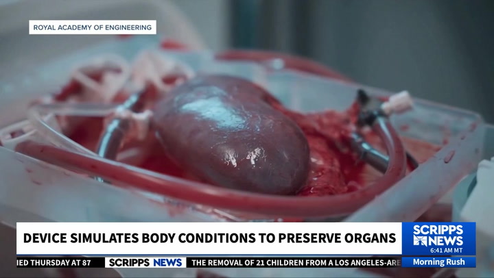 OrganOx: Revolutionary Device Extends Organ Viability for Transplants