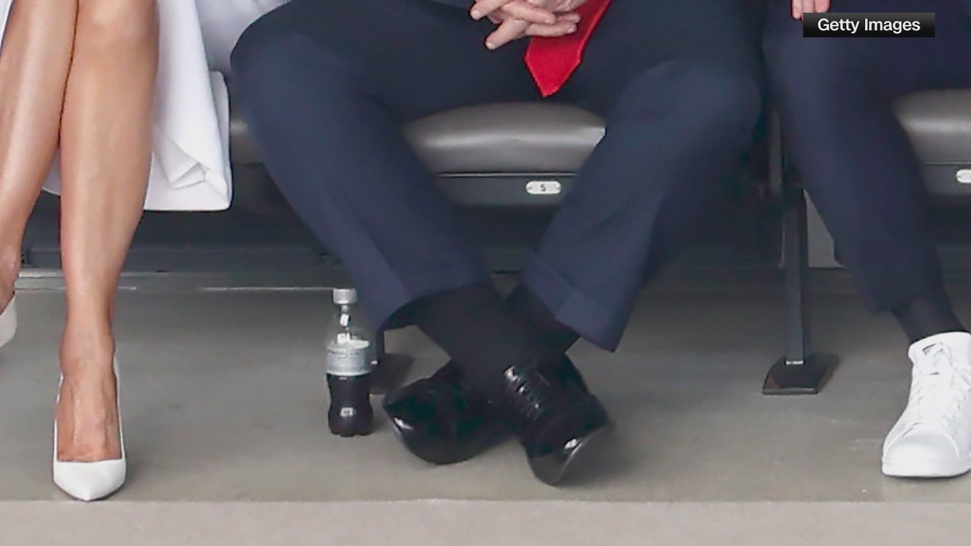 President Trump diagnosed with condition known as chronic venous ...