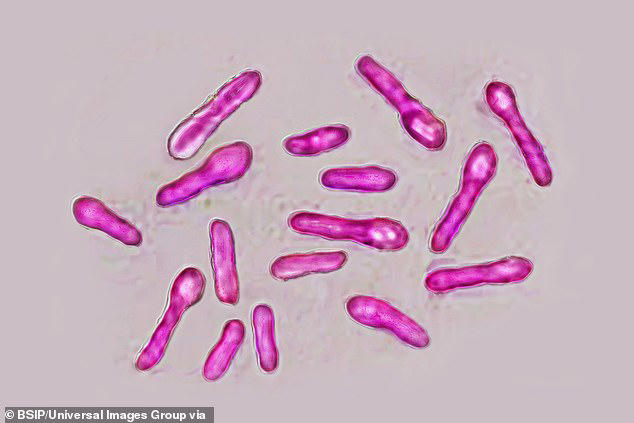 UK health chiefs' urgent warning after outbreak of paralysing botulism ...