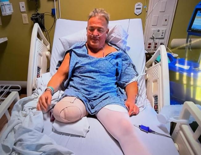 Wrestling legend loses leg after over 30 surgeries
