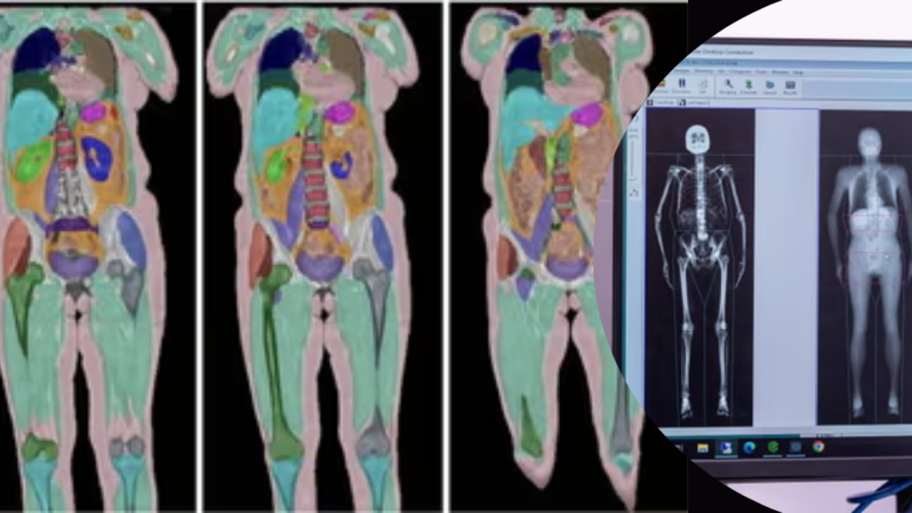 UK Scientists Scan Over 100,000 People, What The Human Imaging Study ...