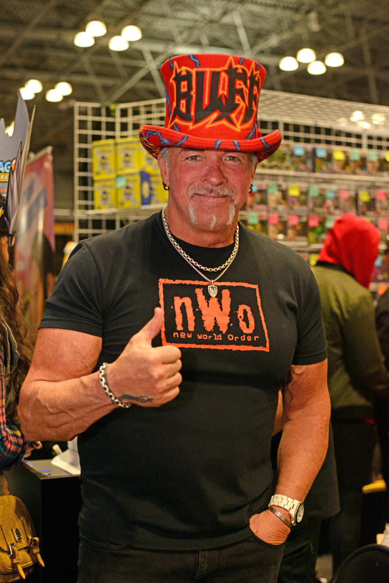 Wrestling legend loses leg after over 30 surgeries