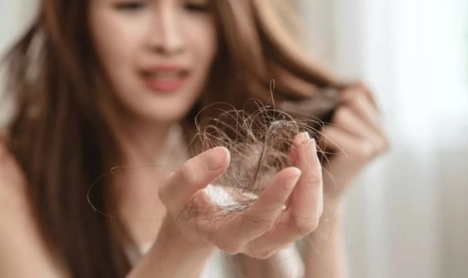 Bahan Alami Paling Efektif Mengatasi Rambut Rontok di Musim Hujan
