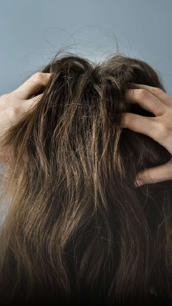 7 Natural Remedies For Scalp Itching In Rainy Season