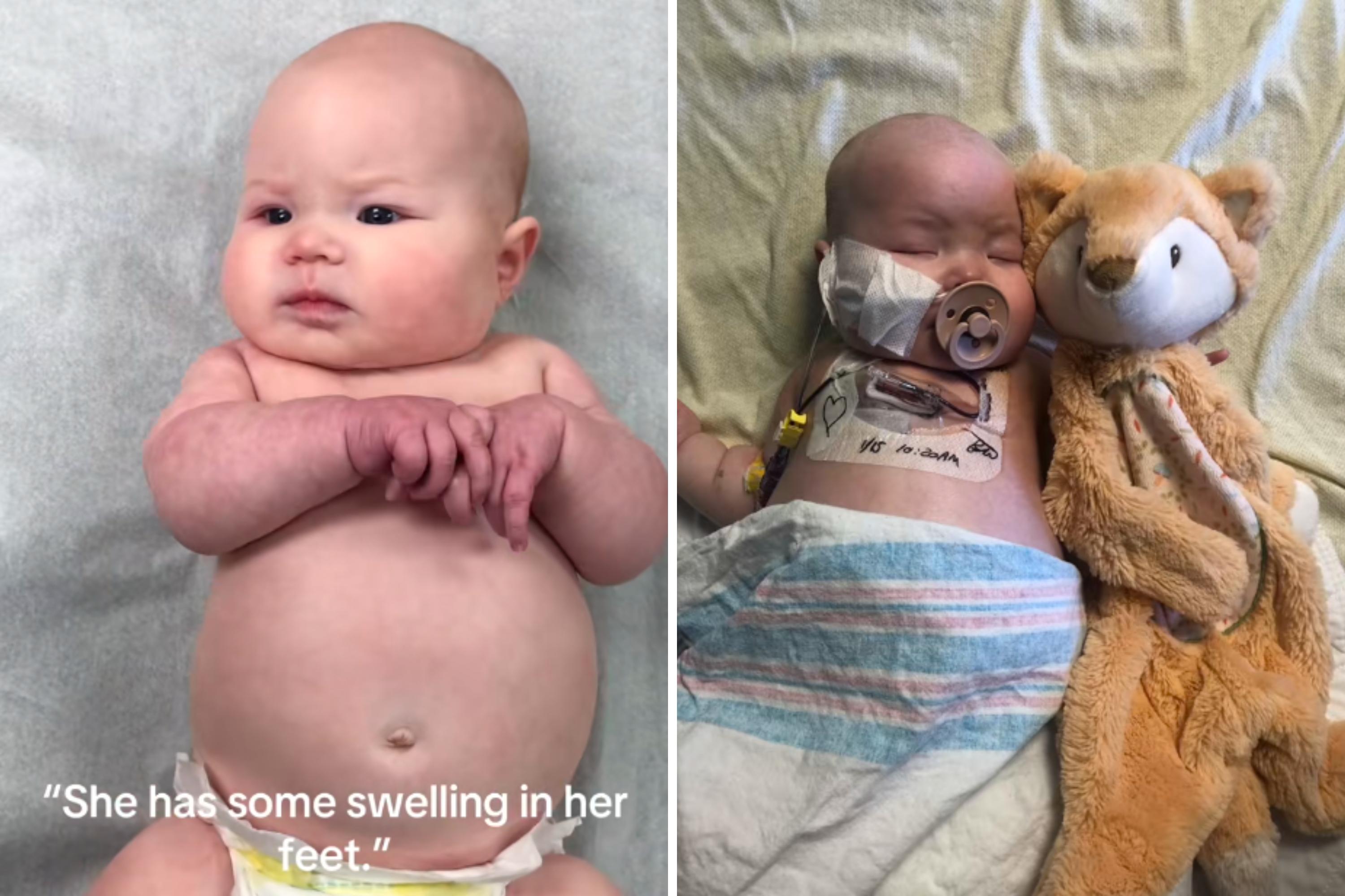 Baby has swollen feet, then parents told devastating reason