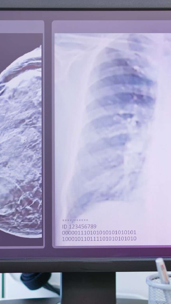 What Is Mammography? Check Its Procedure!