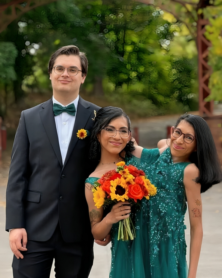 One of the Conjoined Twins Gets Married, People Say the Same Thing