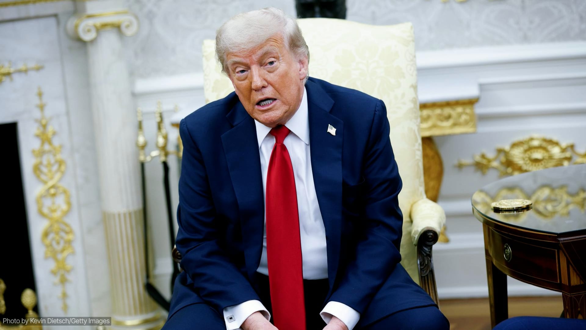 Le diagnostic de Trump : qu'est-ce que l'insuffisance veineuse chronique