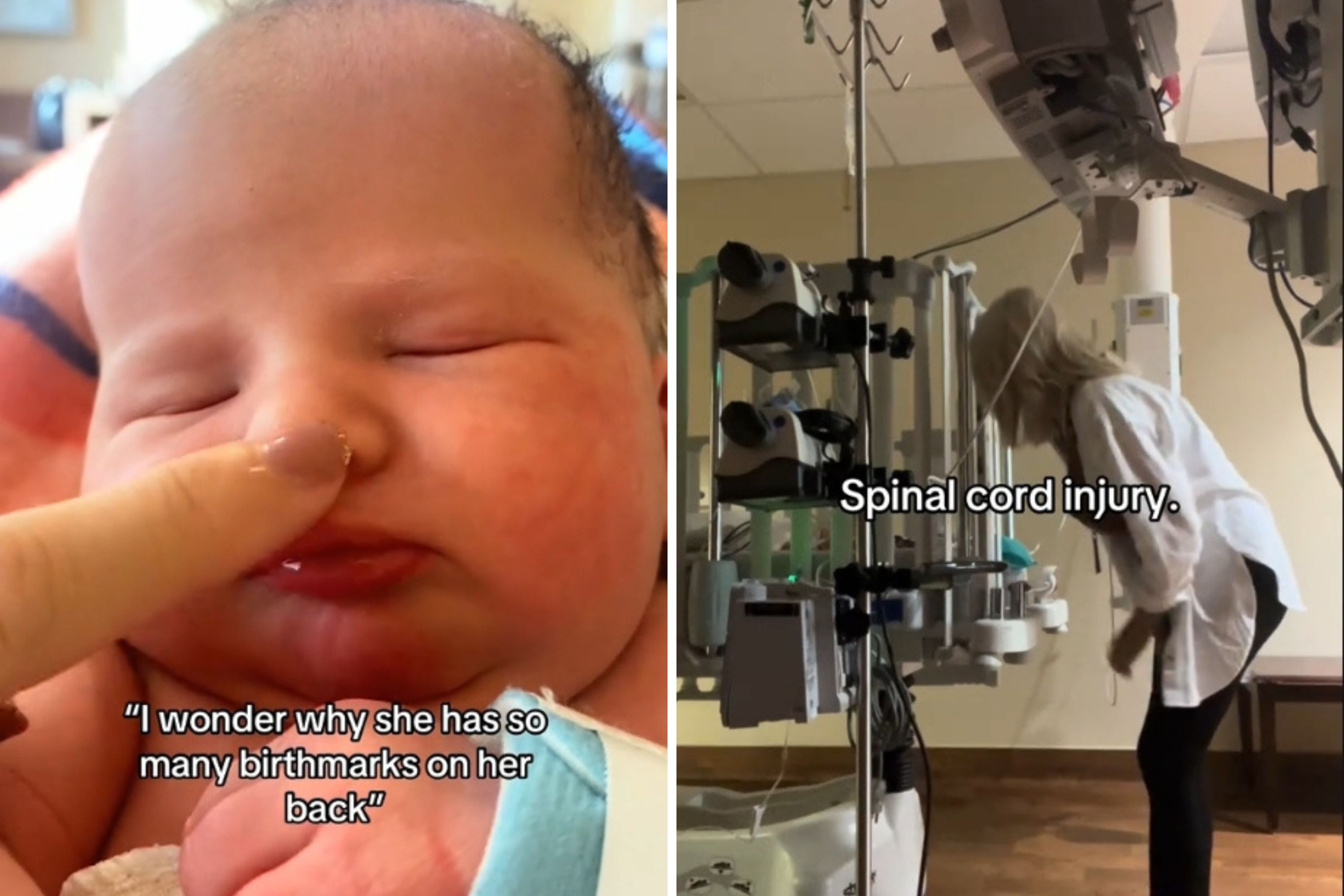 Mom notices baby has birthmarks on back, then comes heartbreaking diagnosis