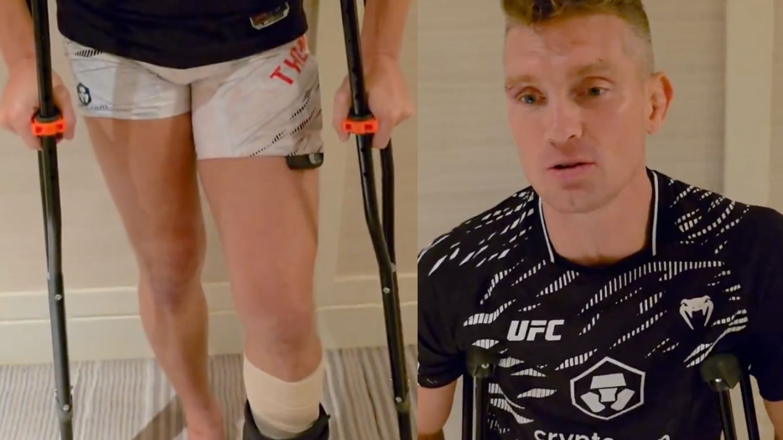 Stephen Thompson Suffers Gruesome Shin Injury in UFC Nashville Loss to ...