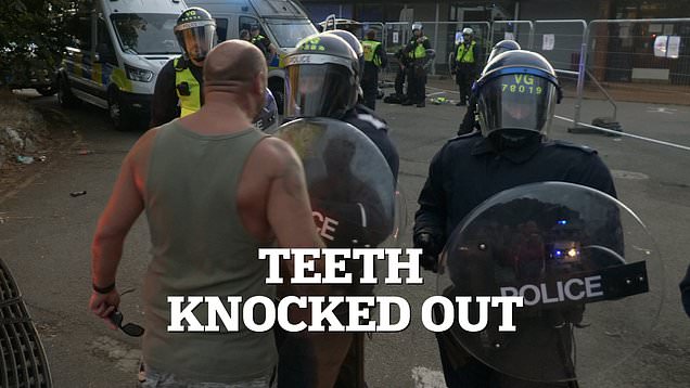 Riot police knocks man's teeth out after smashing shield into face