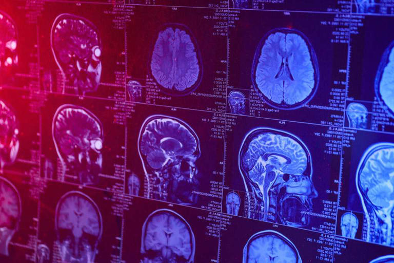 Ce test lit dans votre sang l’âge caché de vos organes… et votre risque ...