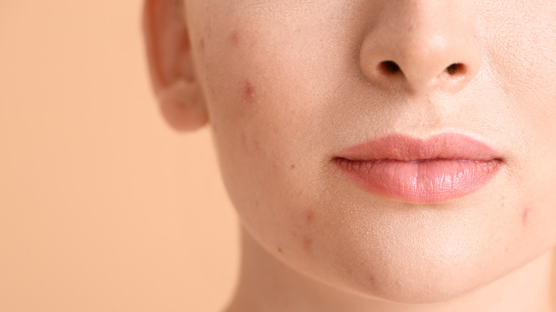 20 Of The Best Face Washes For Acne-Prone Skin