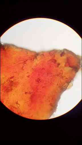 Exploring the Importance of Earwax Under a Microscope