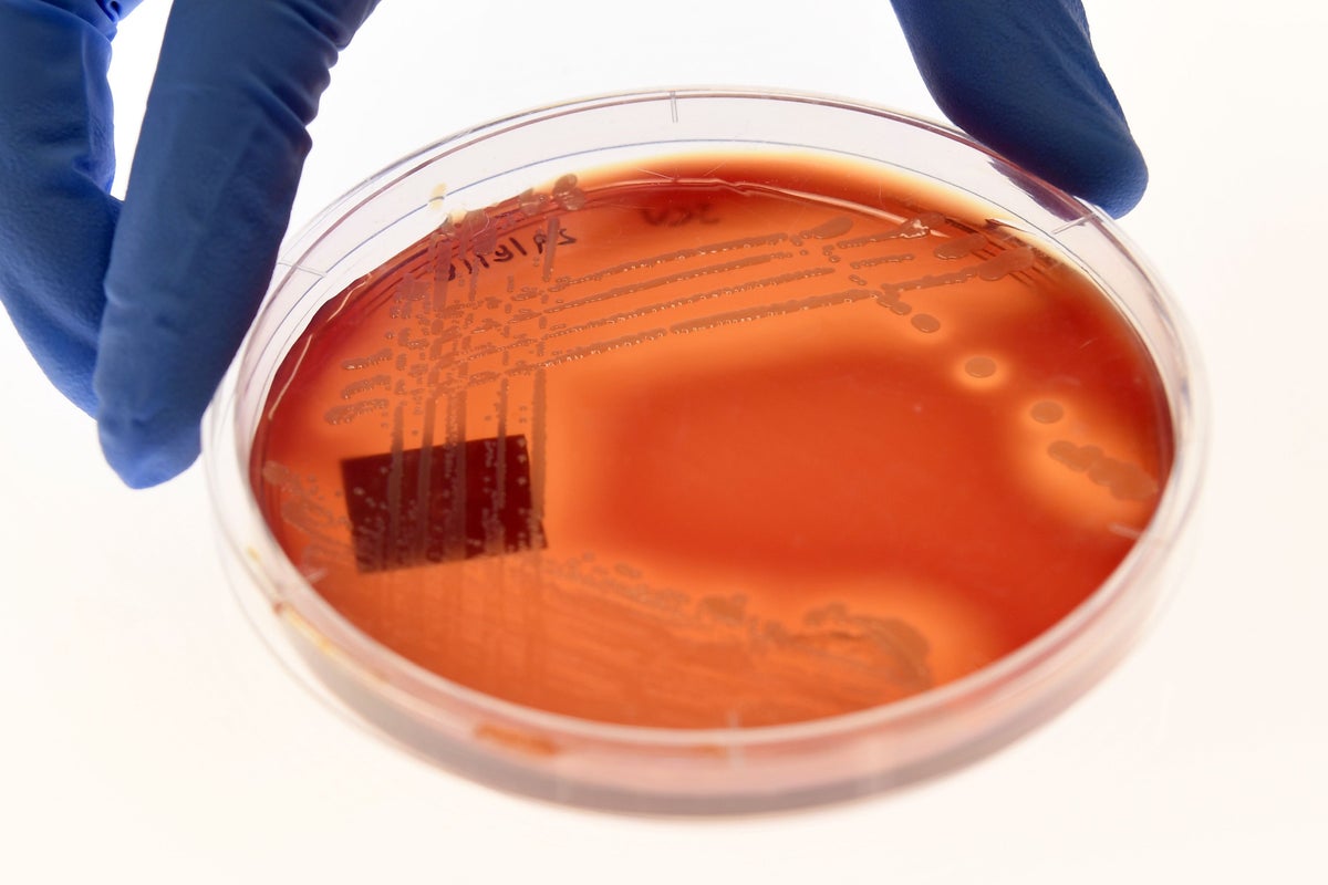 Foreign aid cuts could lead to millions more dying from superbug ...