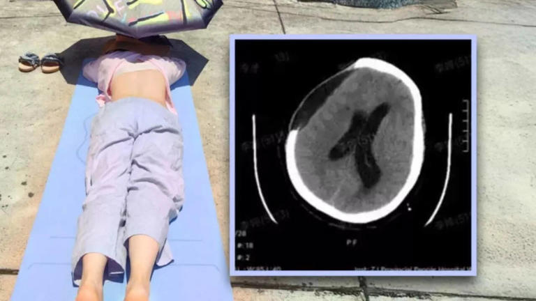 Chinese woman suffers brain hemorrhage, slips into coma after ...