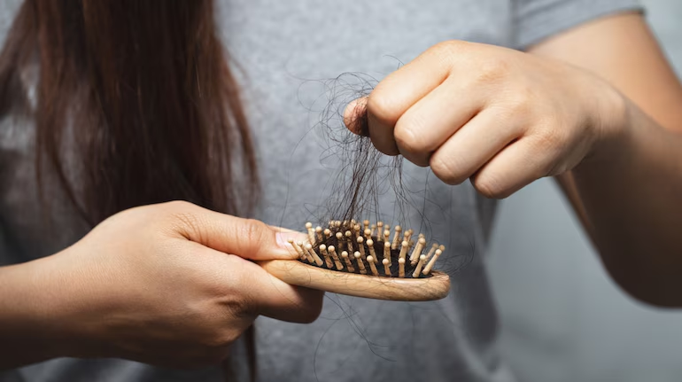 Monsoon Hair Fall Out of Control? This Simple DIY Hair Pack Can Bring ...