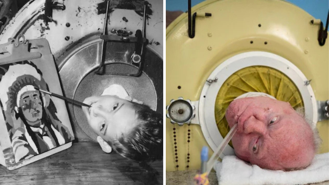 The Man Who Lived 70 Years in an Iron Lung