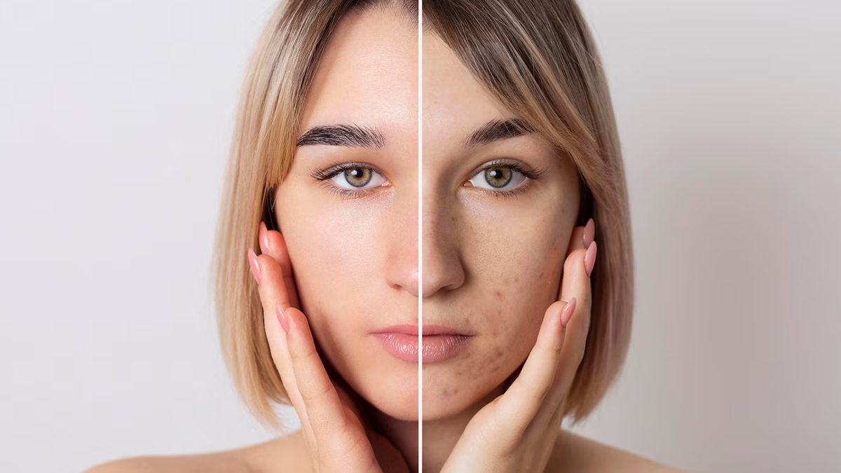 Struggling With Unexplained Skin Darkening? Expert Tells 6 Health ...