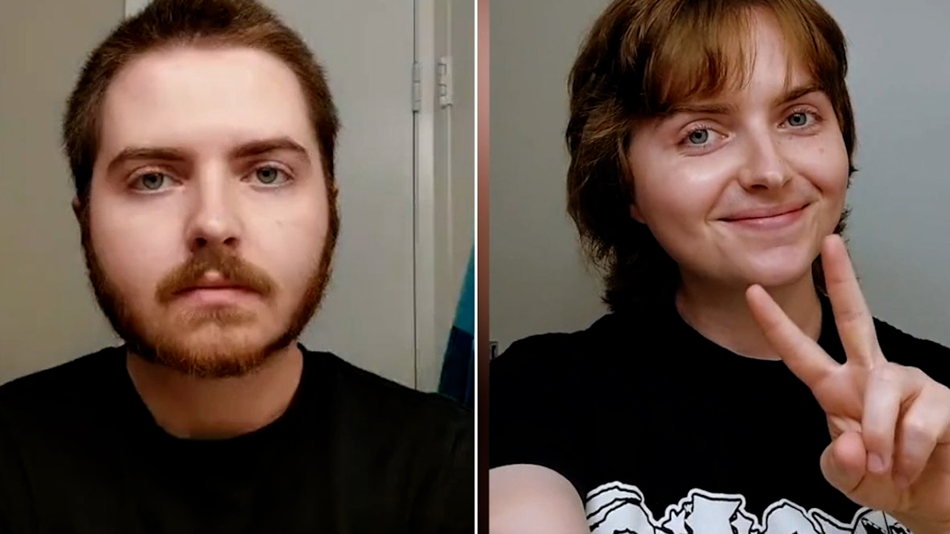 Trans woman documents physical changes by taking a selfie every day for ...