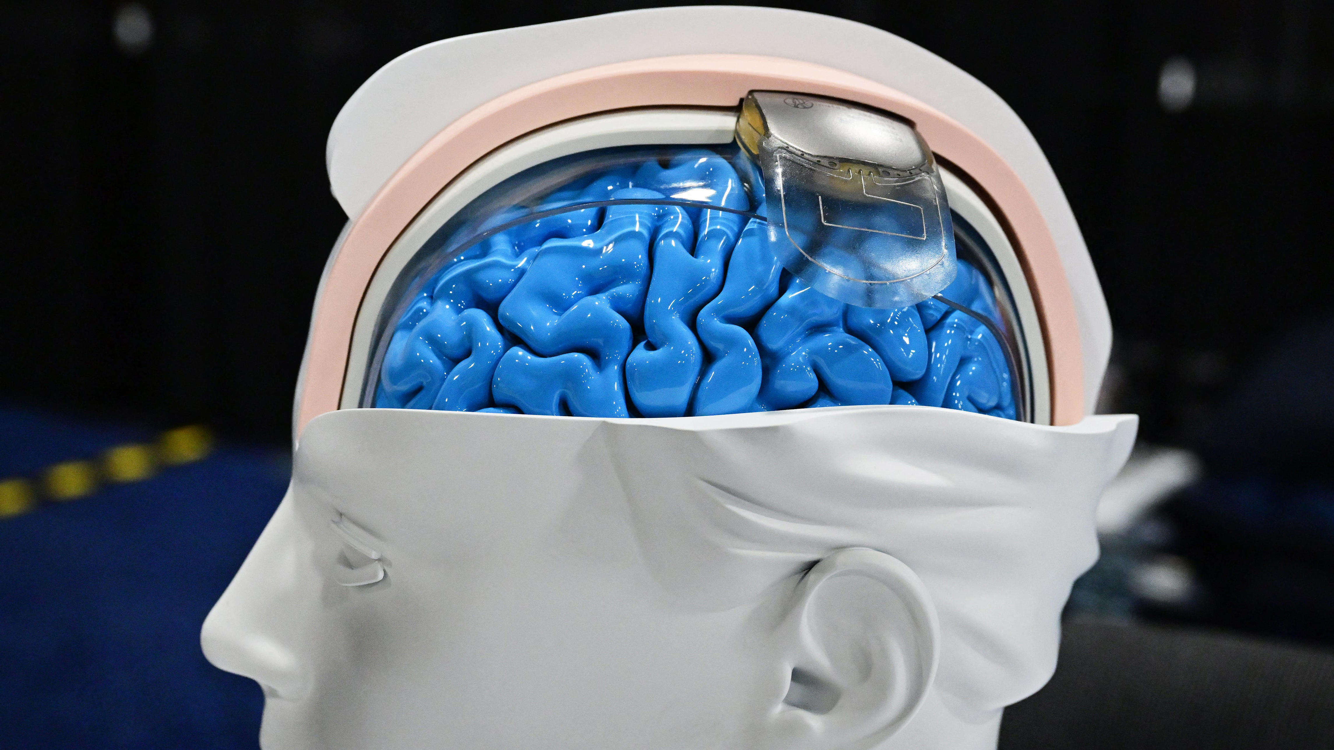 Brain computer interfaces, or BCIs, are helping disabled patients move ...