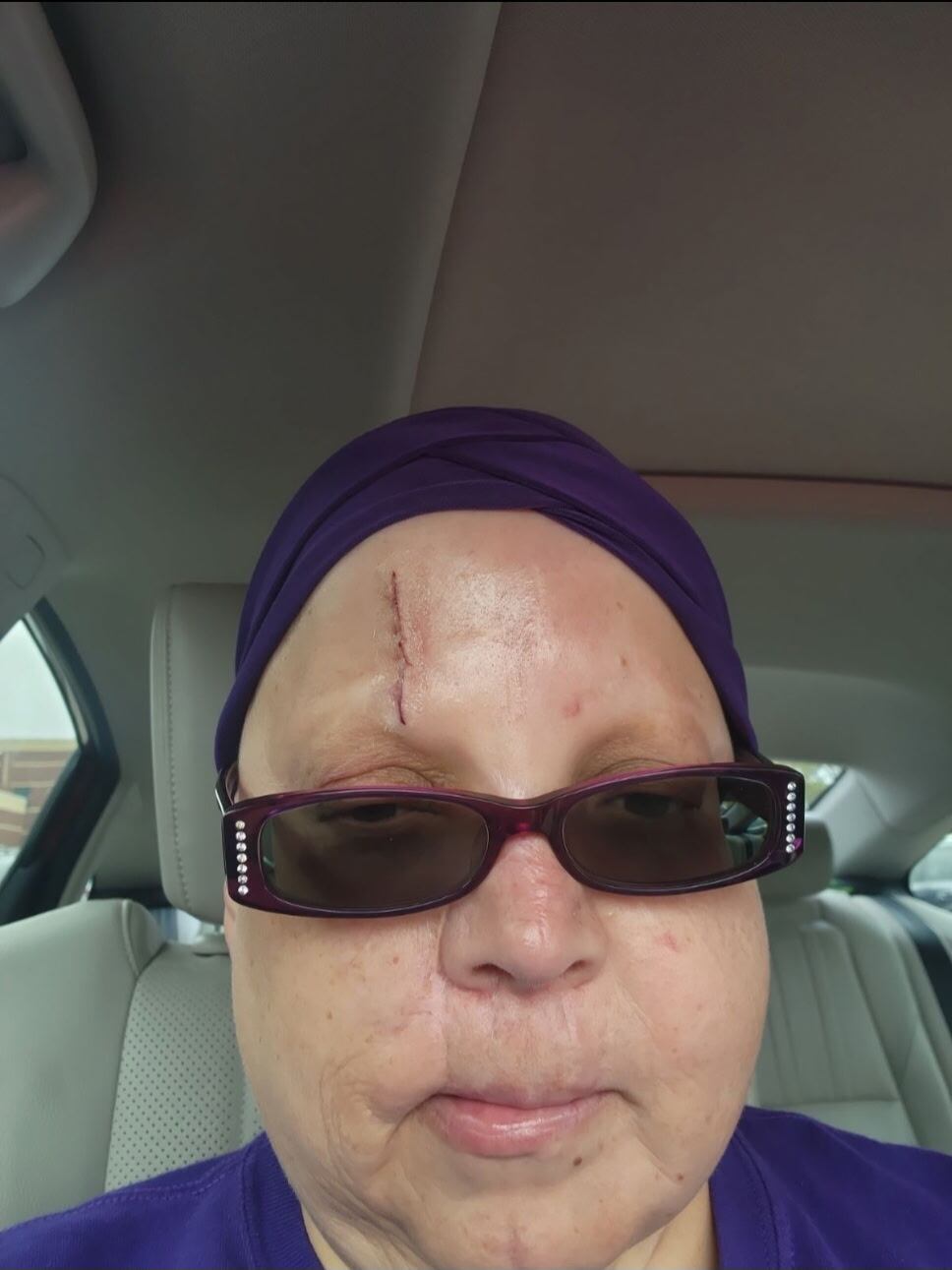 Pueblo cancer patient concerned about ‘One Big Beautiful Bill’ becoming law