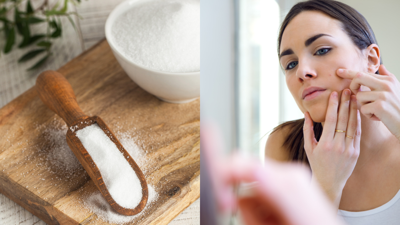Can Natural Sugar Cause Pimples? What to Know About Fructose
