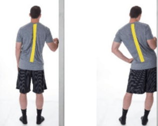 Back Pain? Is your Back Crooked?