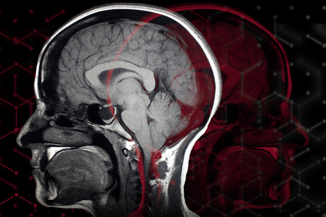 New compound may help the brain heal itself after injury