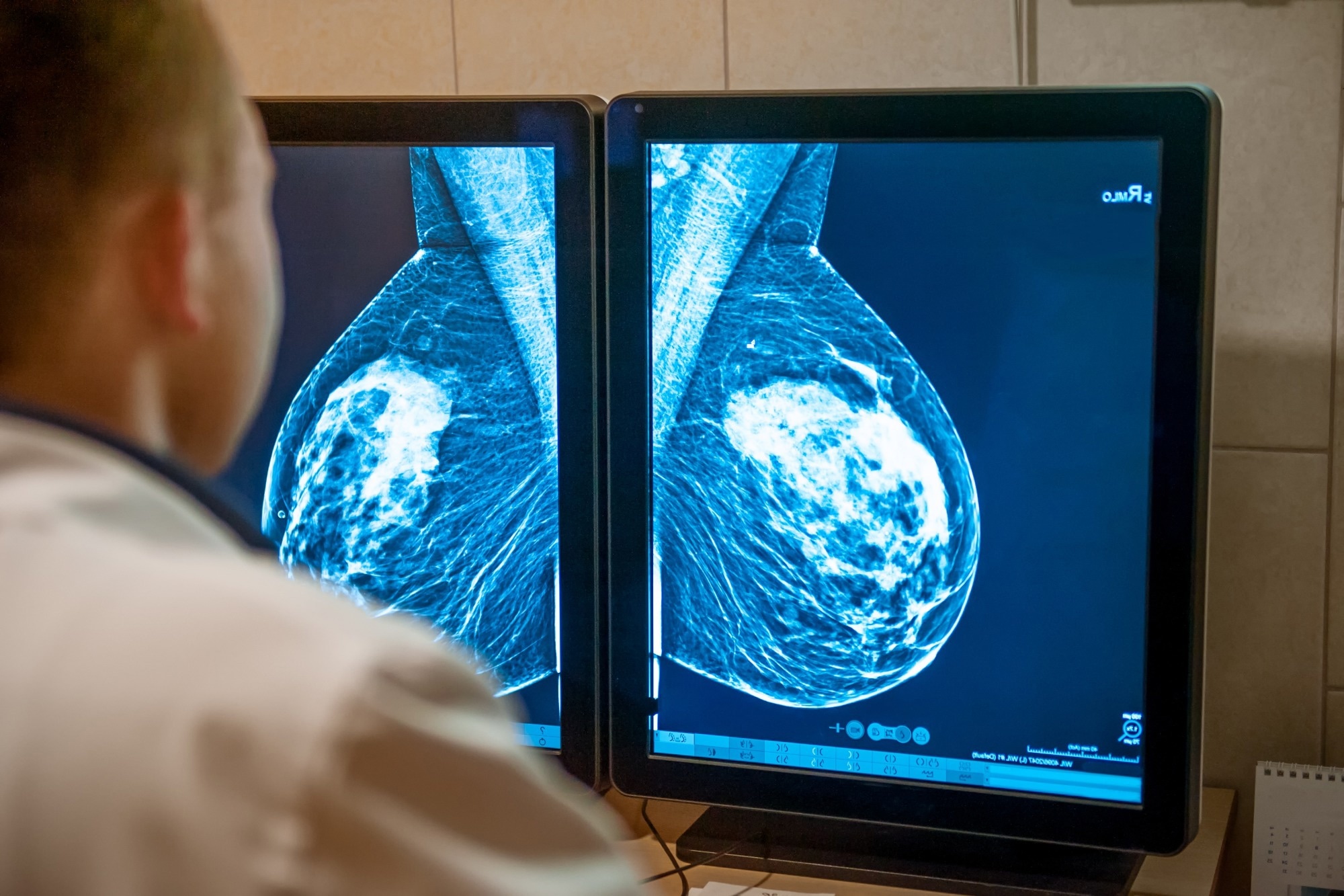 AI-Enhanced Imaging Technique Offers a Safer, More Comfortable Option ...