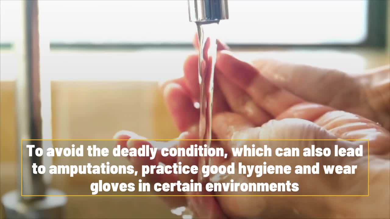 What Is Sepsis And How To Avoid It