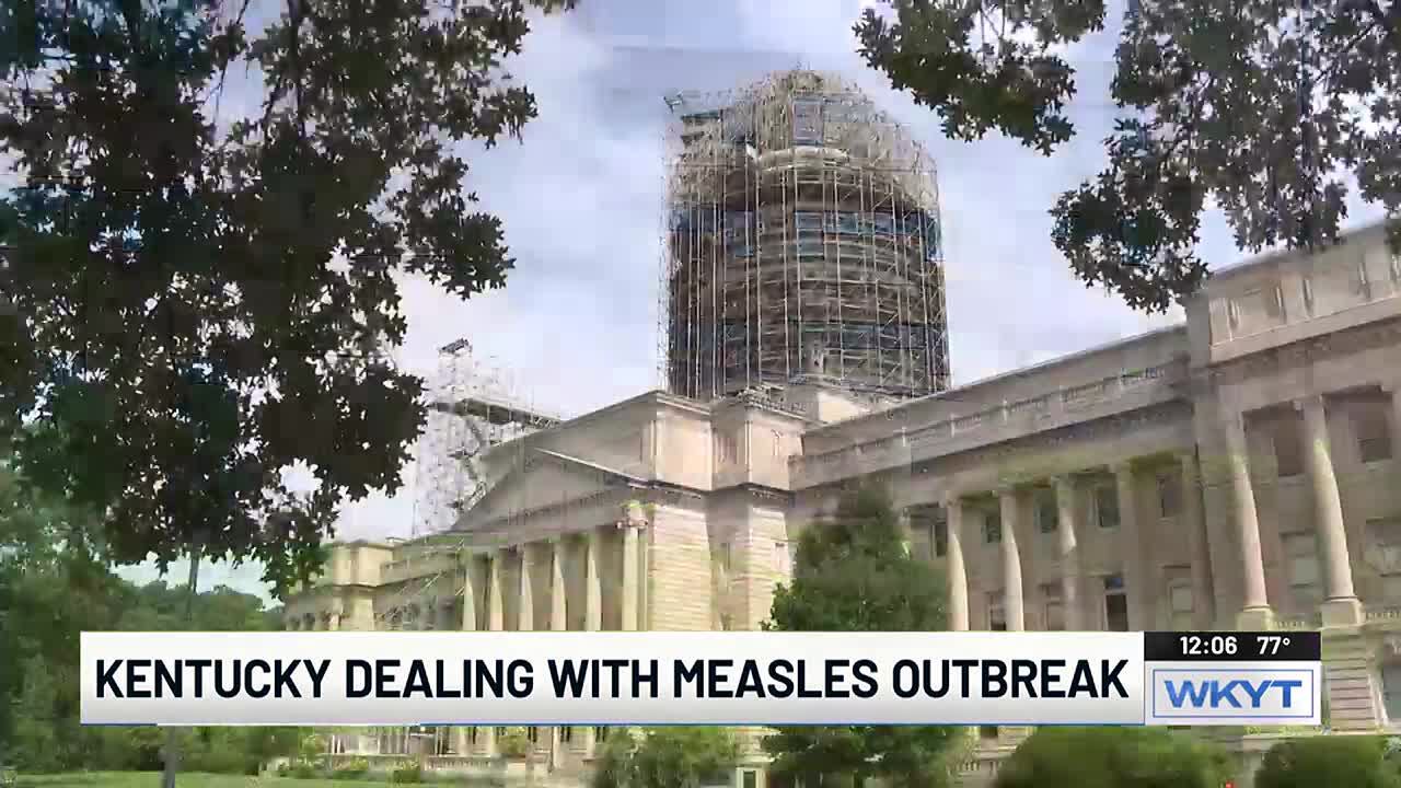 LFCHD confirms 5 new measles cases