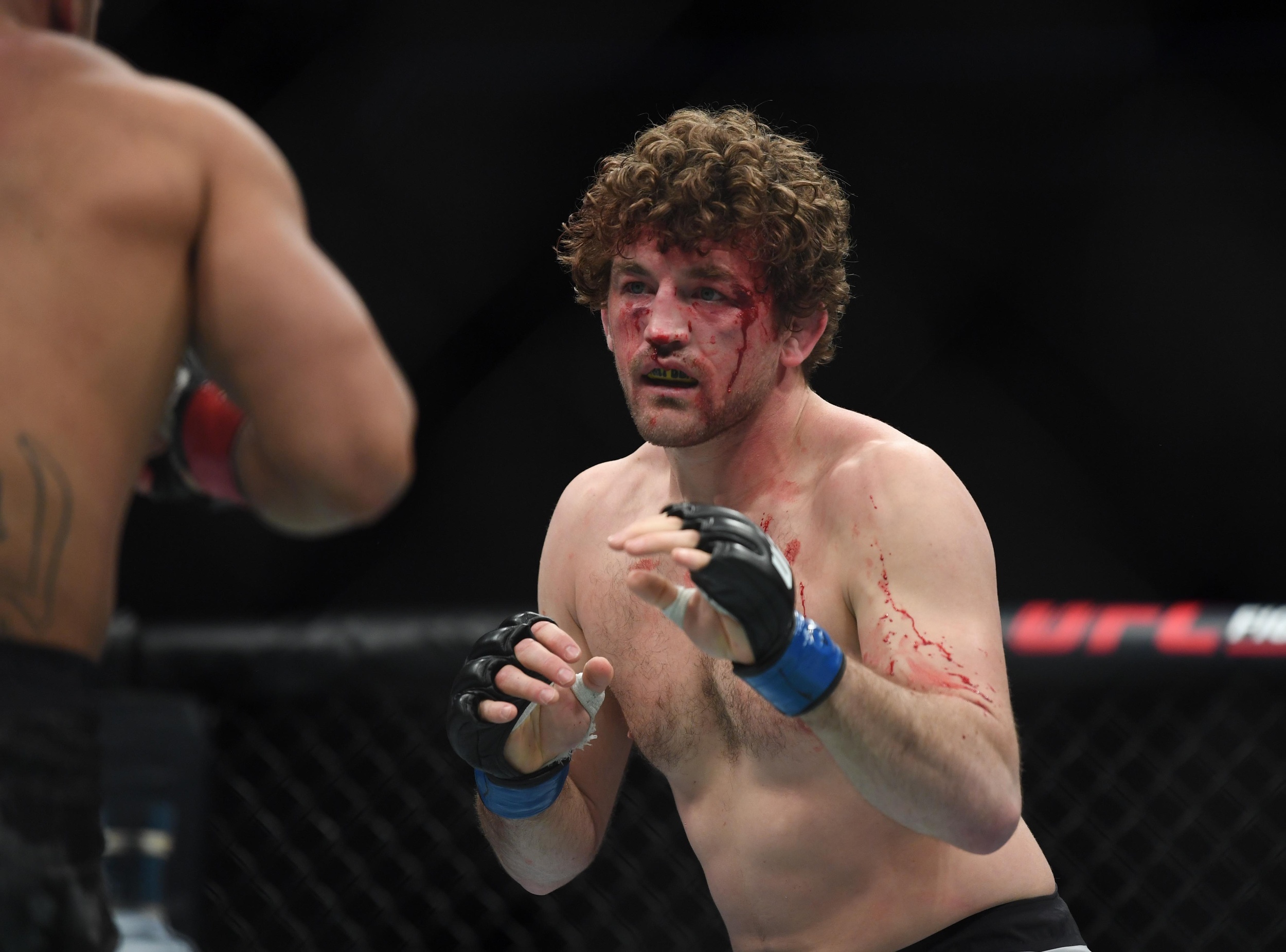 Ben Askren says he ‘died four times’ during health scare