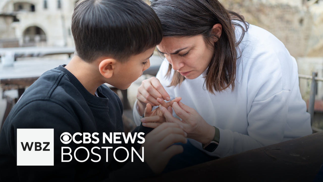 How to safely remove a splinter at home