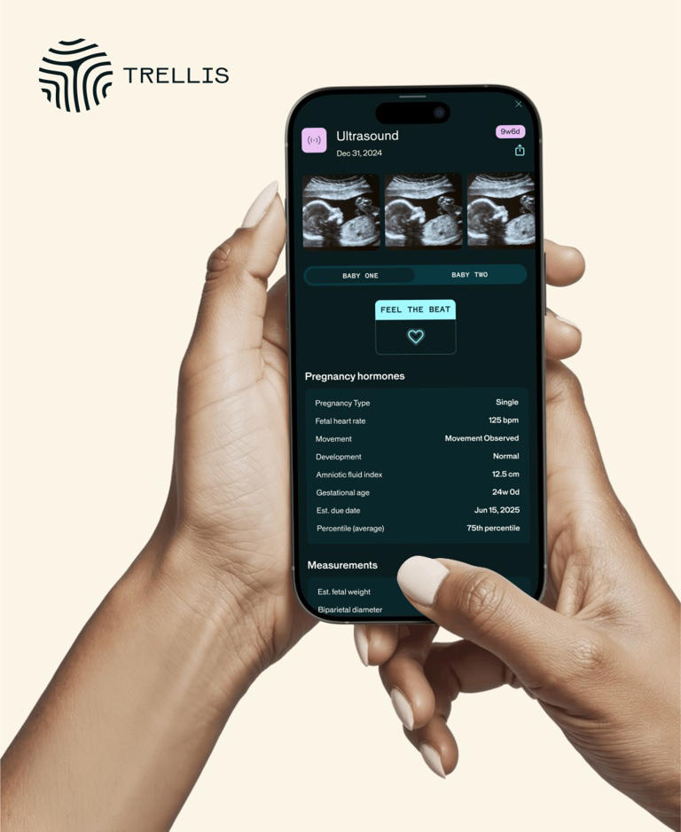 ‘Incredibly moving’ app lets you feel your unborn baby’s heartbeat ...