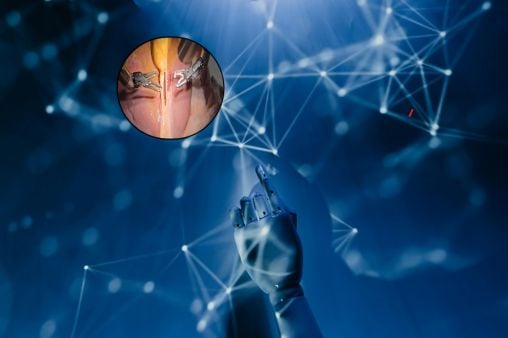 Robot entrenado con IA extirpó vesícula biliar sin ayuda humana ...