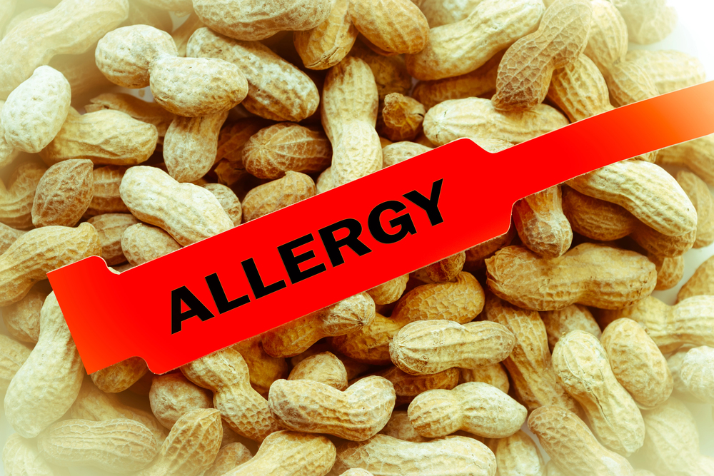 7 Urgent Aldi Food Recalls Every Shopper and Allergy-Aware Parent Needs ...