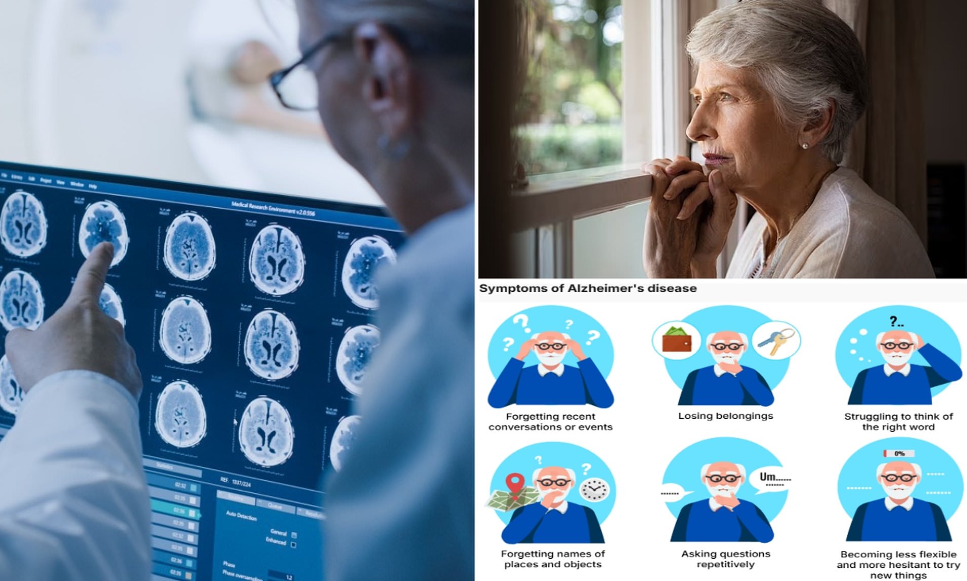 Four 'early warning patterns' that may help prevent dementia before it ...