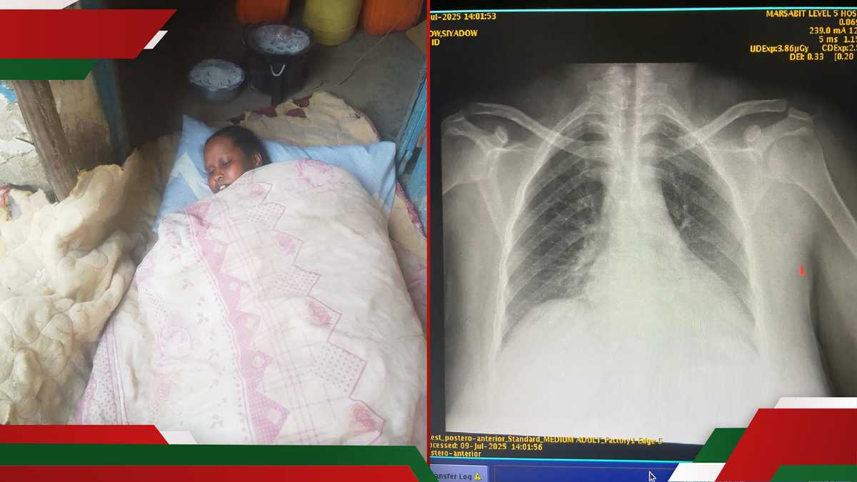 Moyale widow in critical condition after she was diagnosed with swollen ...