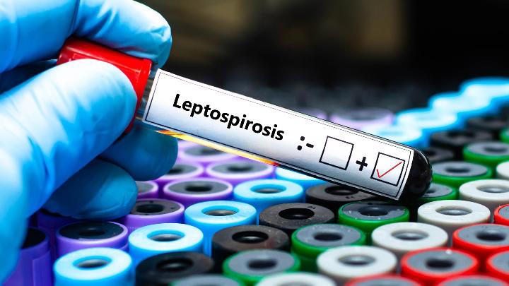 Ketahui Penyakit Leptospirosis dan Pencegahannya